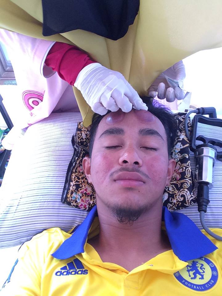 Usahawan Wanita Resdung Bekam Rescue | menarikdi.com